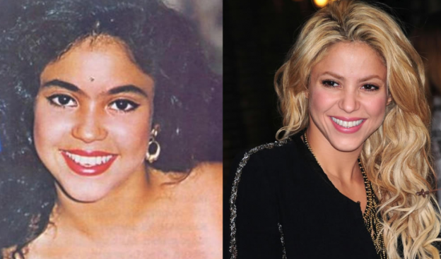 Las FAMOSAS más OPERADAS, ¡cuánto han cambiado!