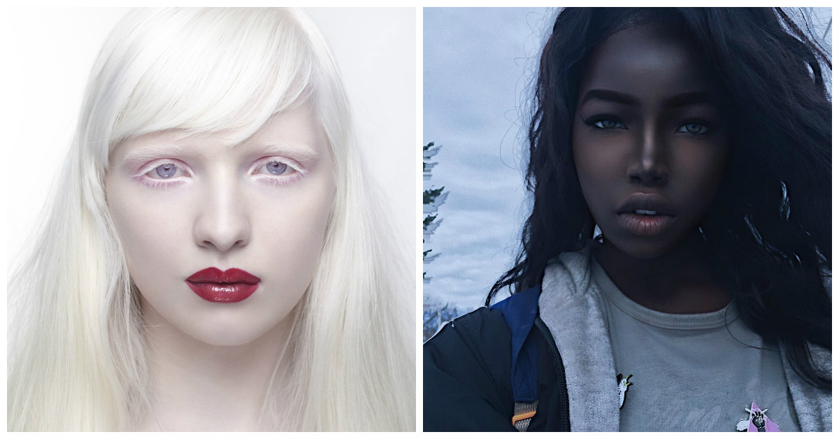 8 personas que destacan por su color de piel único en el mundo - Rebañando